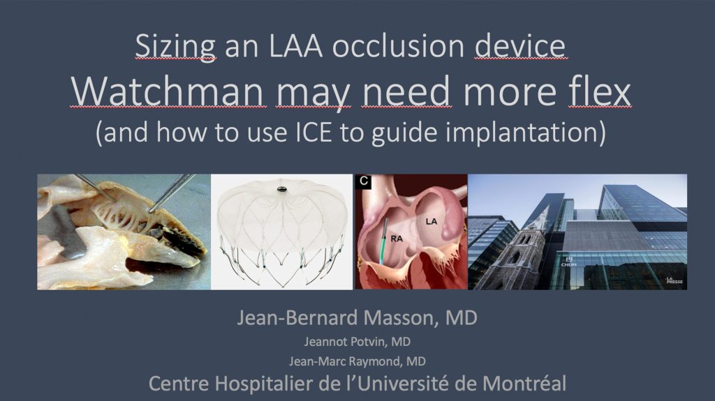 Sizing an LAA occlusion device - Watchman may need more flex (and how ...